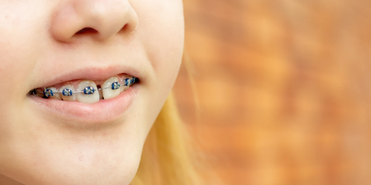 Dientes Grandes Y Fuertes